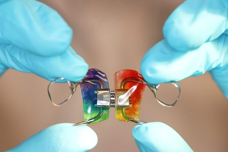 Expanders | Pearl Family Dental Care | Best Dentist In Pearl City, HI